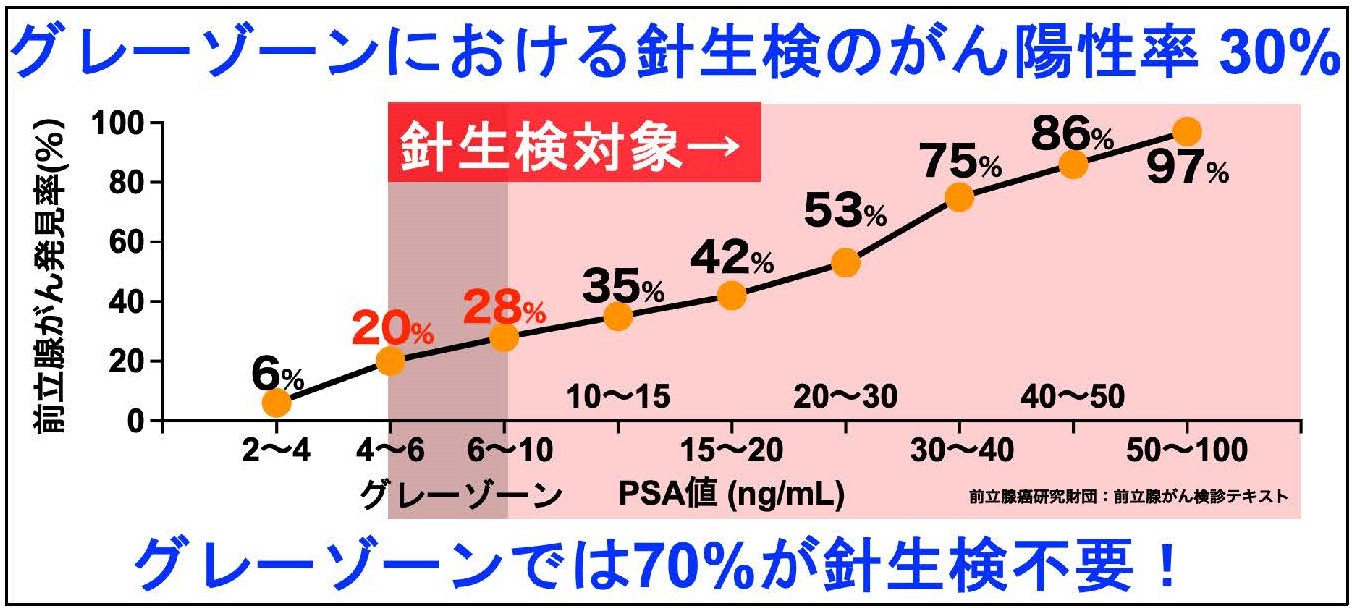 前立腺がん診断の精度を飛躍的に高める国産の新規診断法「S2,3PSA%検査」の共同開発と実用化について - 弘前大学
